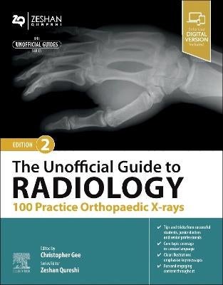 The Unofficial Guide to Radiology: 100 Practice Orthopaedic X-rays by ...