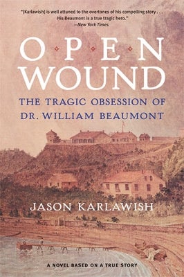 Open Wound by Jason Karlawish | Paper Plus