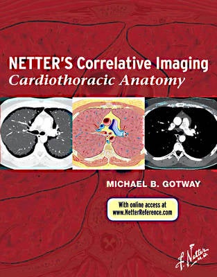 Netter's Correlative Imaging: Cardiothoracic Anatomy by Michael B ...