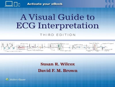 A Visual Guide to ECG Interpretation: Print + eBook with Multimedia by ...